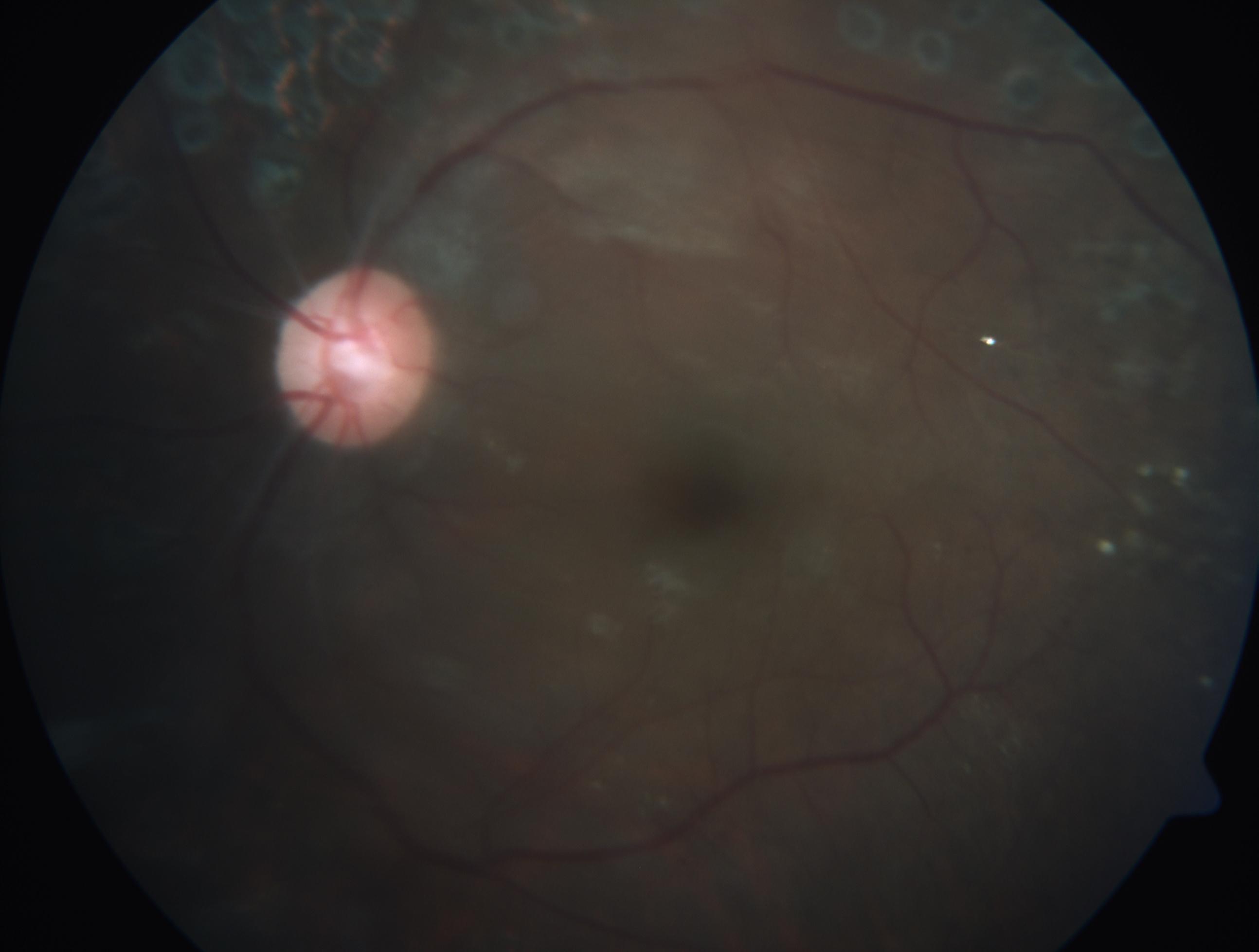 YOLO Object Detection Dataset and Pre-Trained Model by Retina DR