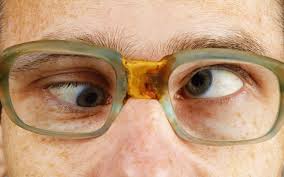 Eye disease Object Detection Model by eyes