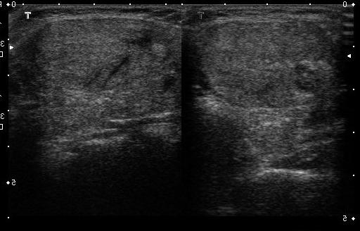 Nitin Gopal kalal - Roboflow Universe