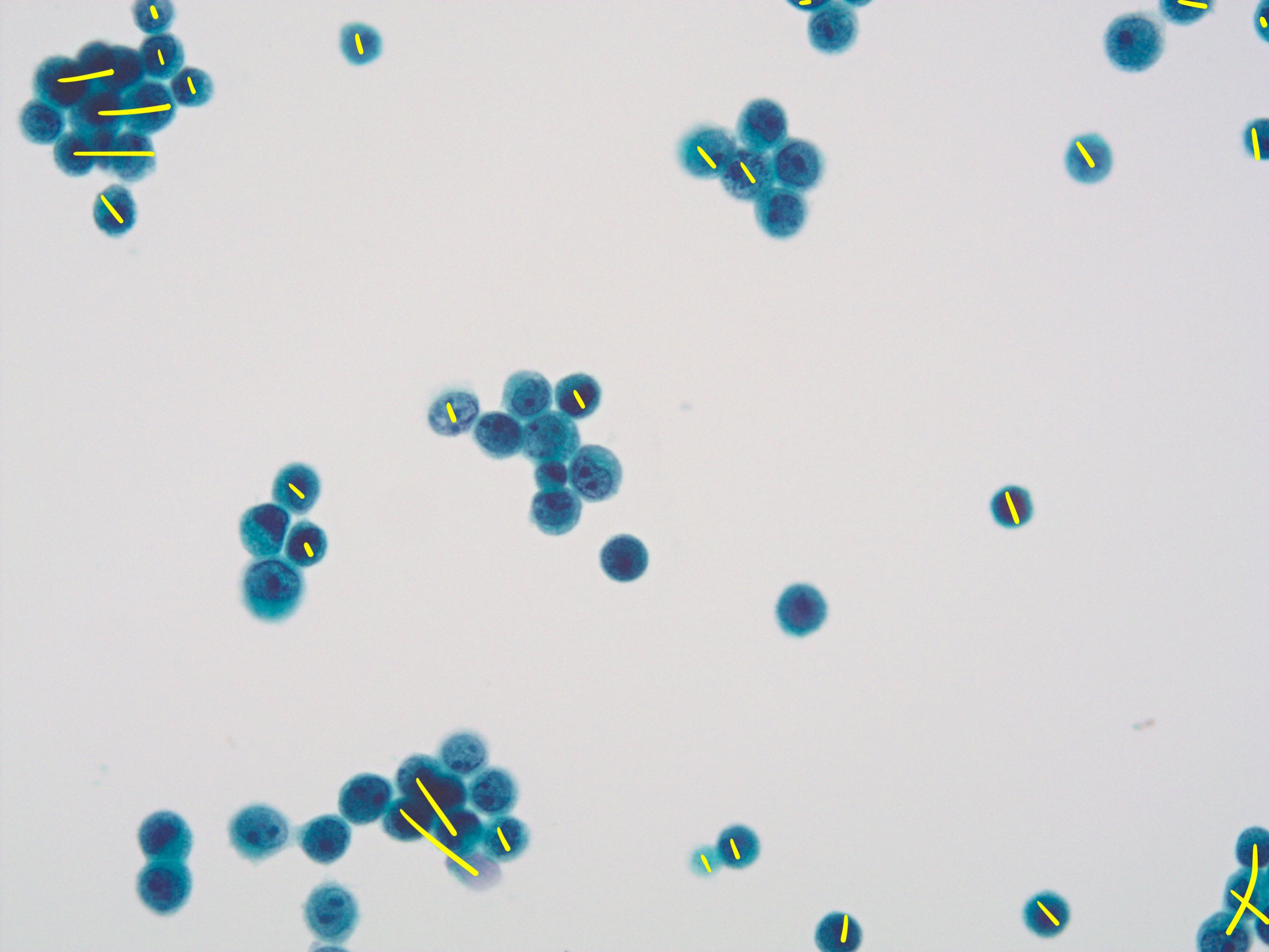 Hep Instance Segmentation Dataset by Cell morphological changes and object detection