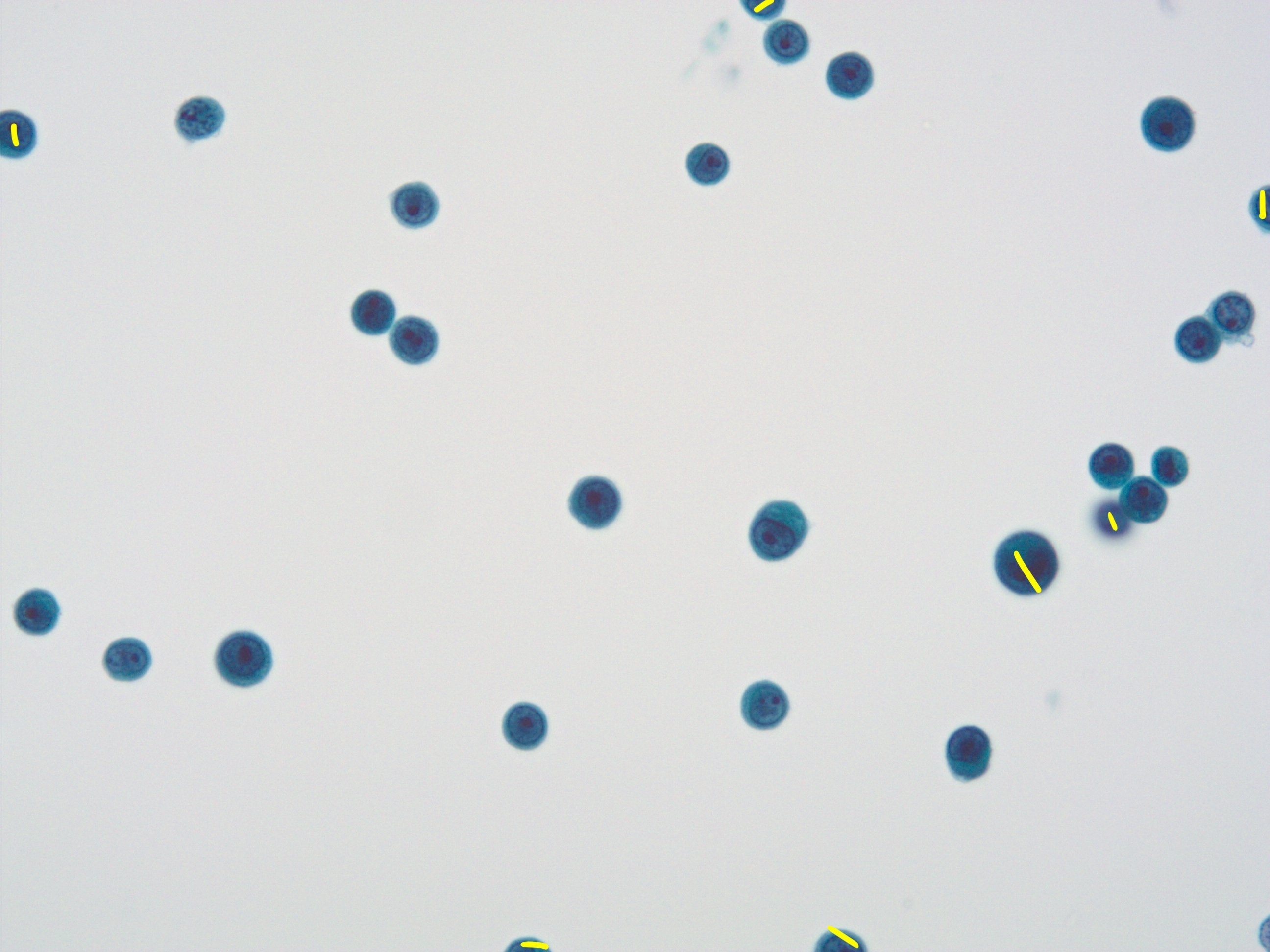 AC Instance Segmentation Dataset by Cell morphological changes and object detection
