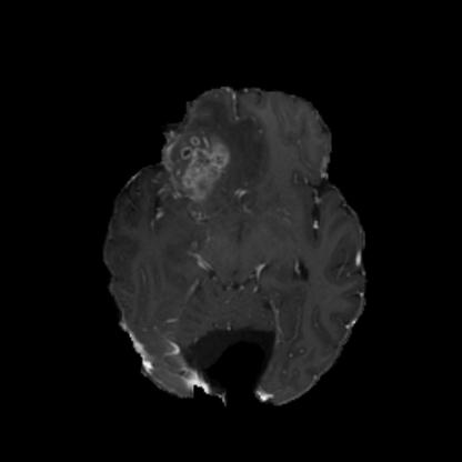 Brain Tumor Object Detection Model by braintumor