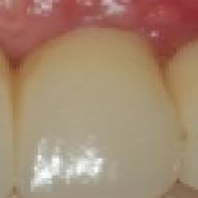 Classification Calculus level Classification Dataset by Rizka Milandga