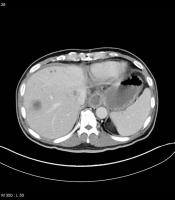 How to Use the pancreas ct Instance Segmentation API