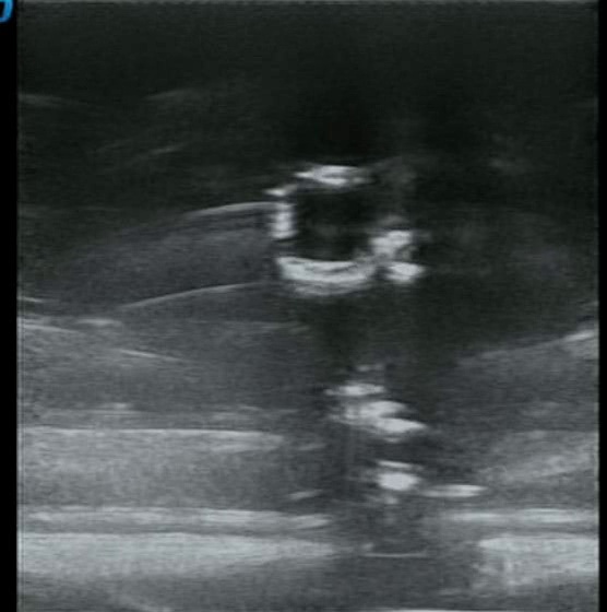 lab (lab-4nlha) - Roboflow Universe