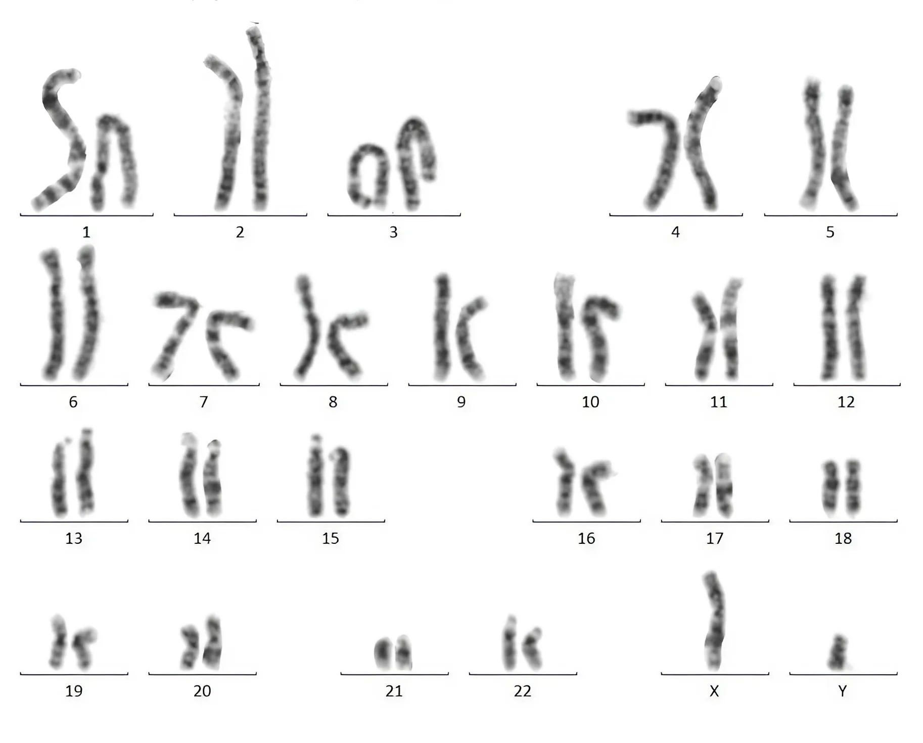 Nhận Diện Nst Object Detection Dataset And Pre Trained Model By Yolonst