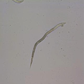 Nematode Object Detection Dataset by Eric