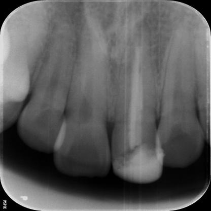 R cua tren bo sung Object Detection Dataset by vqc