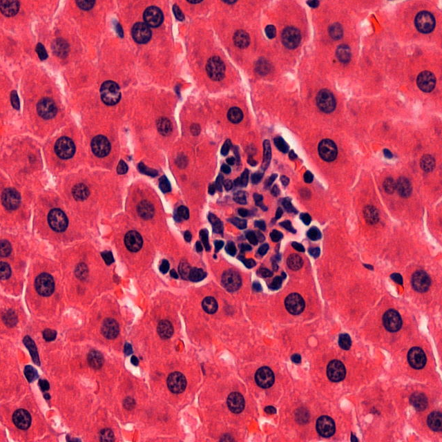 liver Object Detection Dataset and Pre-Trained Model by bmdrc