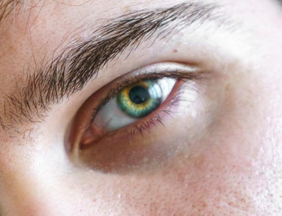 eye_v2 Classification Dataset by DƯƠNG ĐỨC CƯỜNG