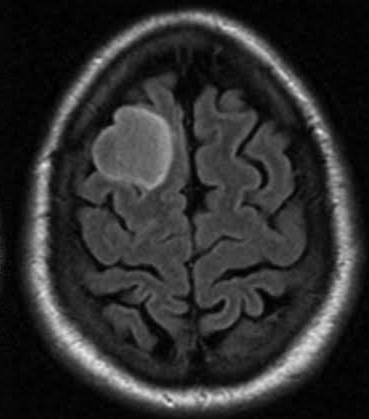 yolov5-dataset24 Instance Segmentation Dataset by Gauhati University