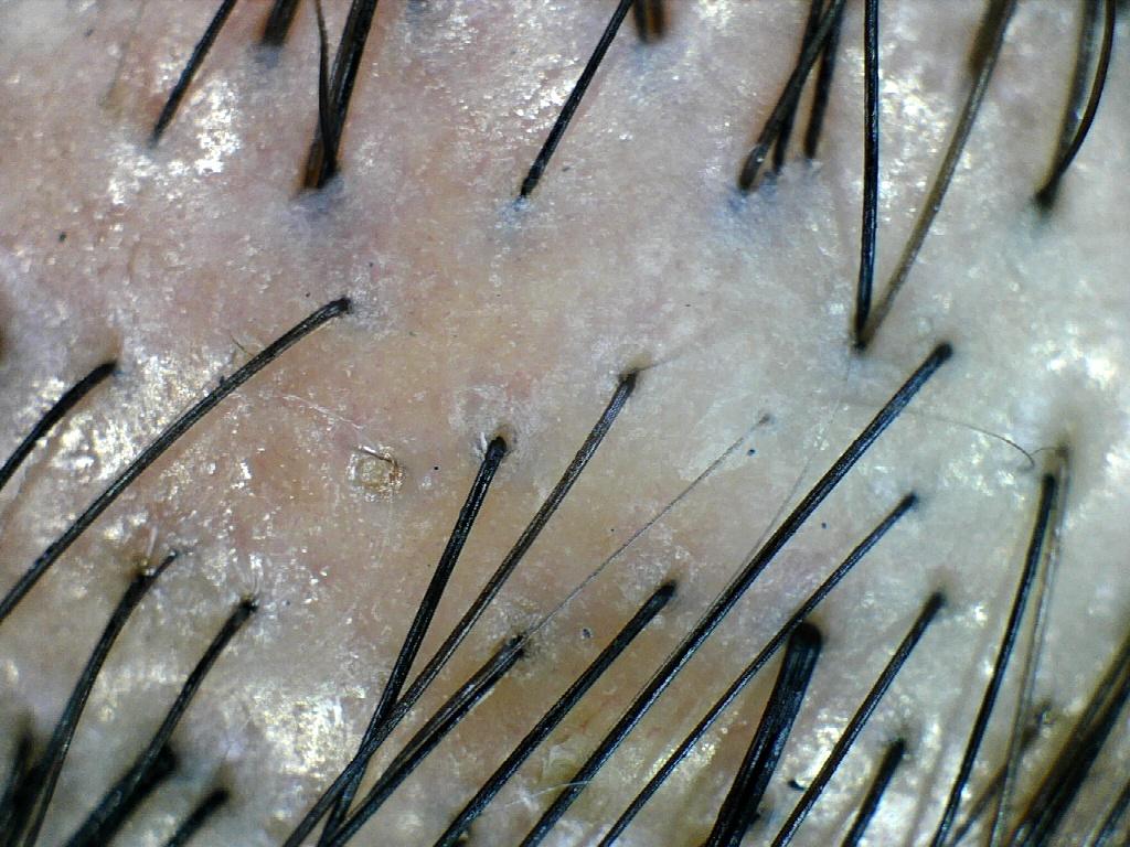 smart brush Object Detection Dataset by Aurelia