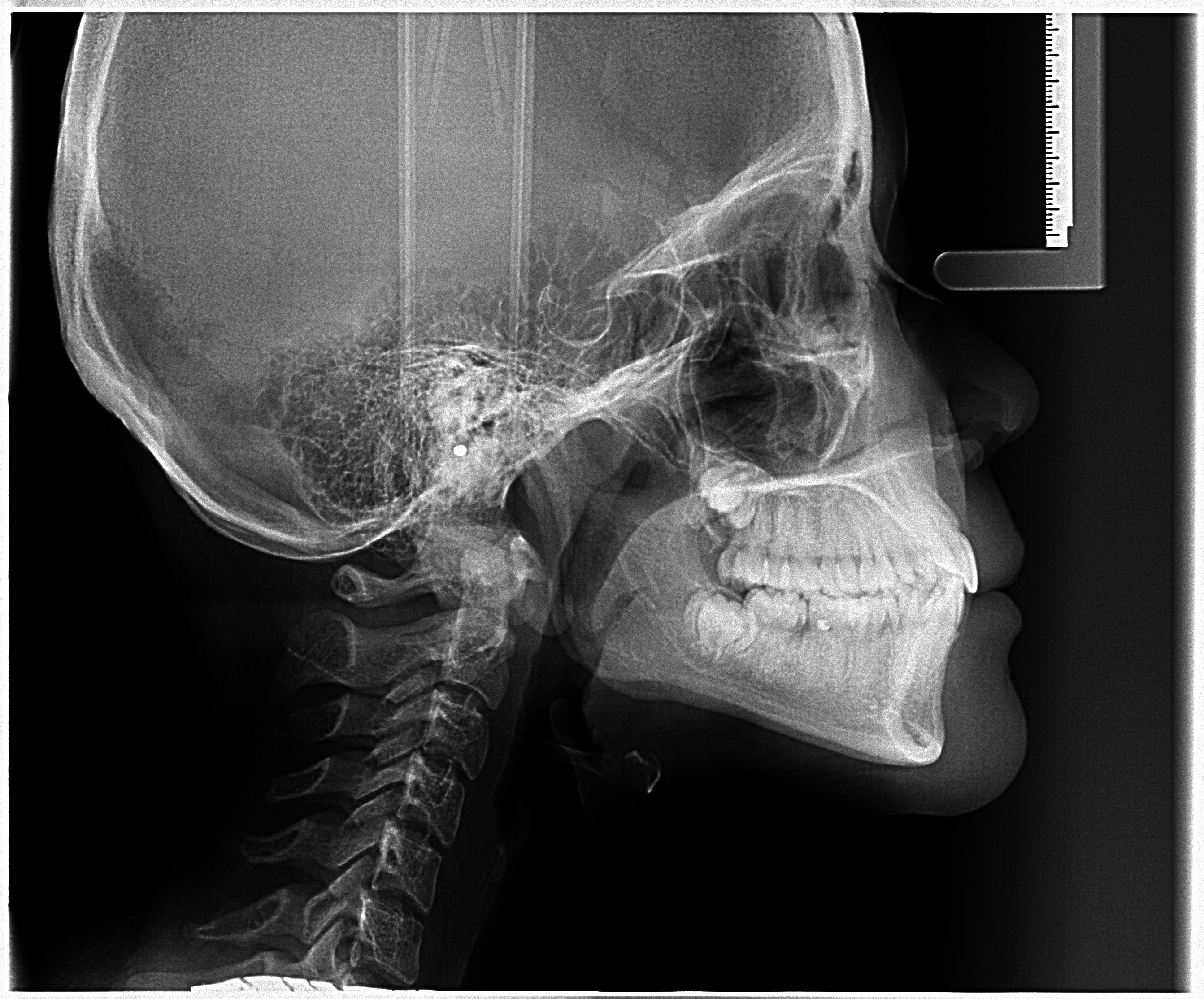 Simulasi1 Object Detection Dataset by ITB