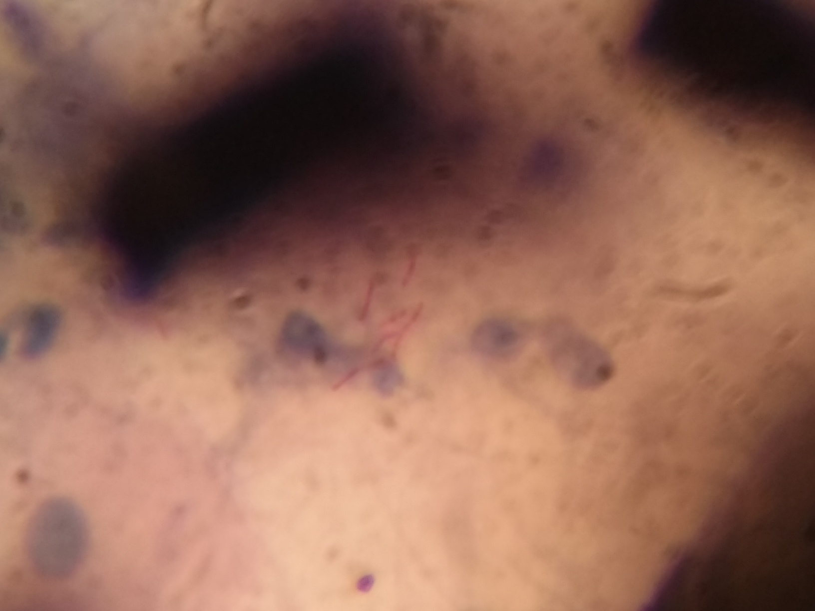 TBC KAGGLE Object Detection Model by Daves Workspace