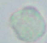 urine Object Detection Dataset and Pre-Trained Model by oj