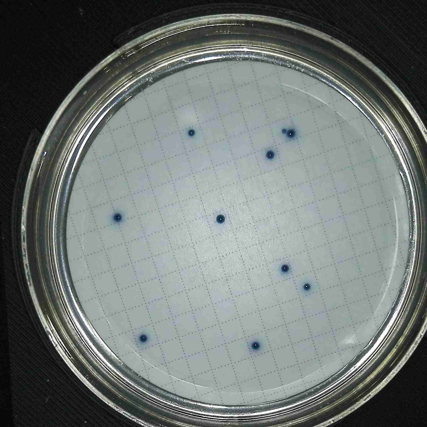 Colony-detector Object Detection Dataset by Gytworkz