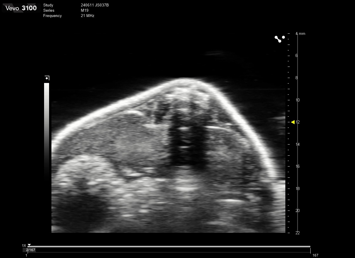 Tumor Segmentation Instance Segmentation Dataset And Pre Trained Model