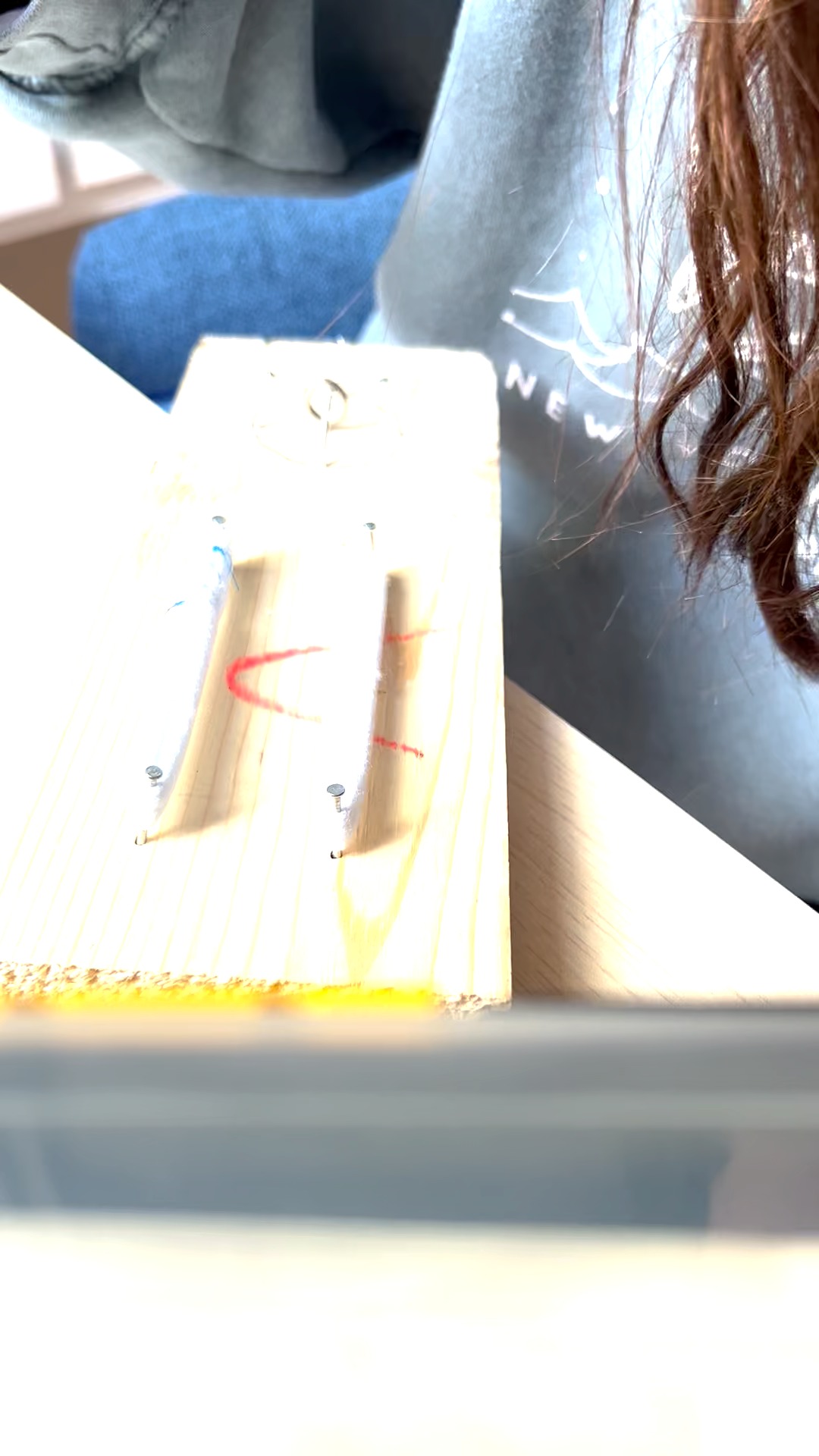 surgery Keypoint Detection Model by AEYE