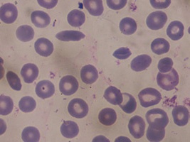 SCA Types identification Object Detection Dataset by cardboard