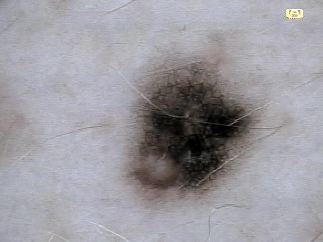 Automated Masking Semantic Segmentation Dataset By Skin Lesion Masking