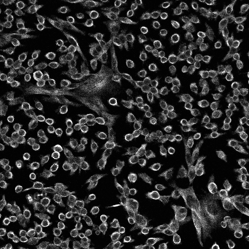 SAM2 Fine-Tuning Instance Segmentation Dataset by sh1239