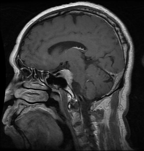 brain Classification Dataset by GITTI