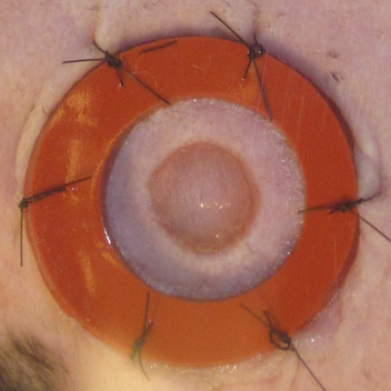 How to Use the WoundSegmentationData Instance Segmentation API