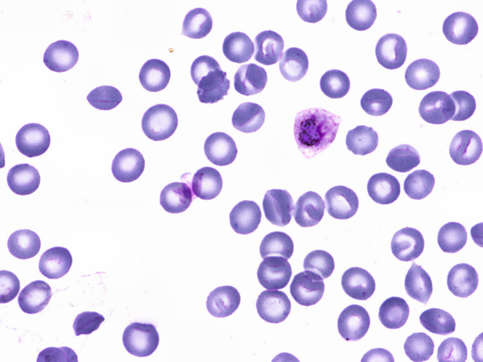 malaria detection Classification Dataset by eb