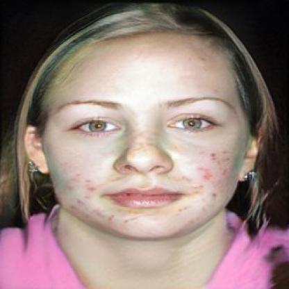 class:left-cheek | Roboflow Universe Search