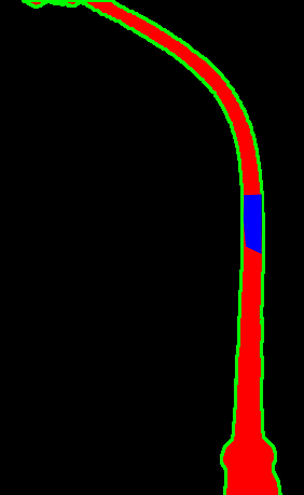 Normal and Abnormal Computer Vision Dataset by Lobster