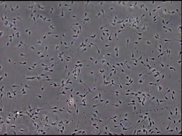 Sperm Object Detection Dataset by new-workspace-lt5oz