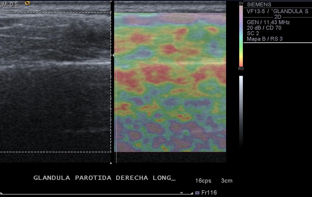 Ruiz Moreno Rosa Instance Segmentation Dataset by ProtocoloSjogren