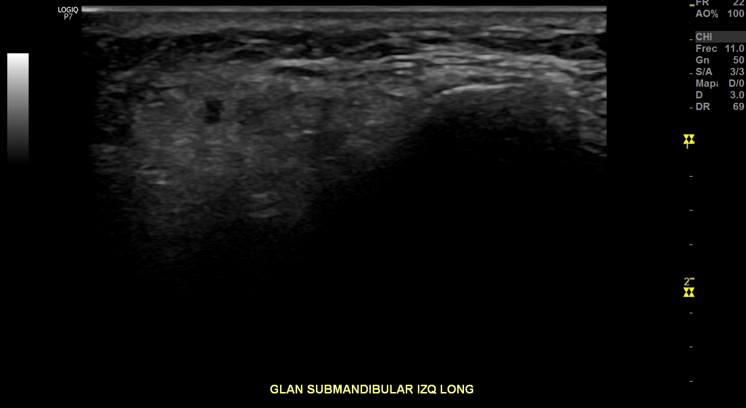 Lucas Palacio Letica Instance Segmentation Dataset by ProtocoloSjogren