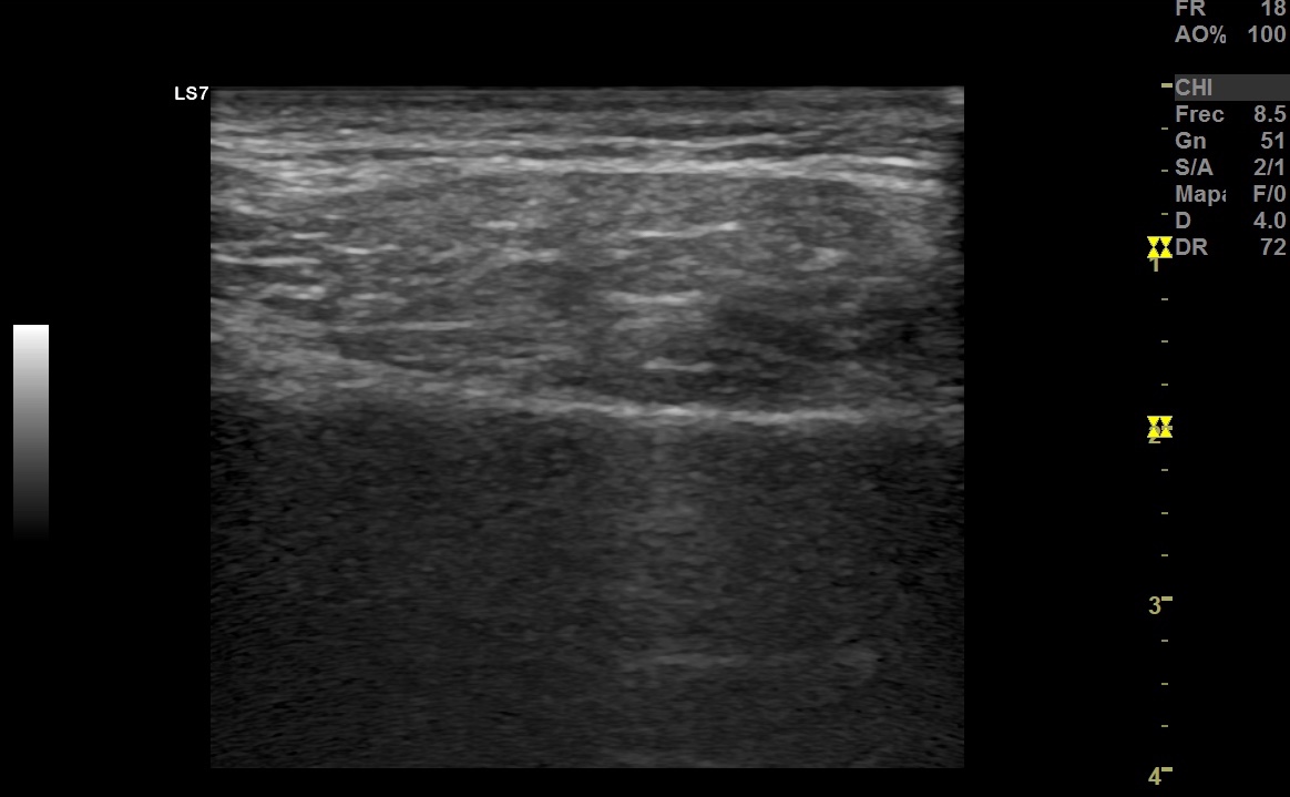 Lopez Moreno Ines Instance Segmentation Dataset by ProtocoloSjogren