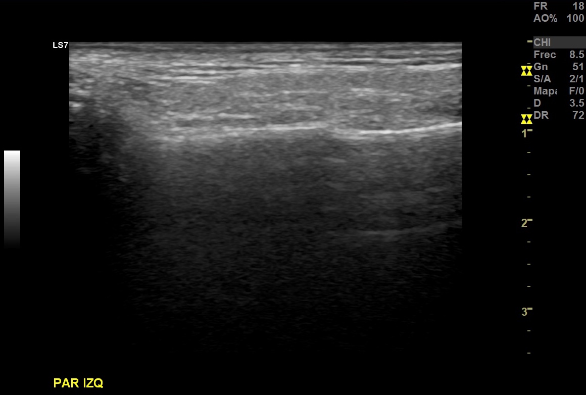 Chimal Medina Martha Instance Segmentation Dataset by ProtocoloSjogren