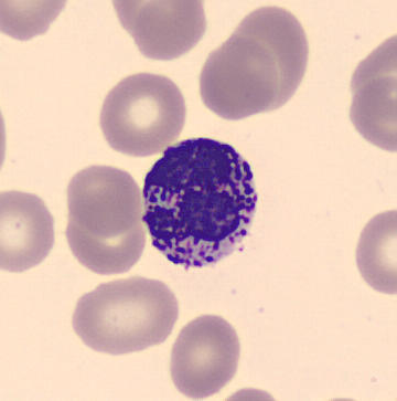 white blood cell Object Detection Model by KMOU