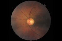 first9owing - Roboflow Universe