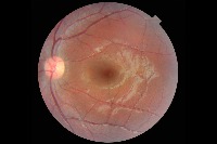 first9owing - Roboflow Universe