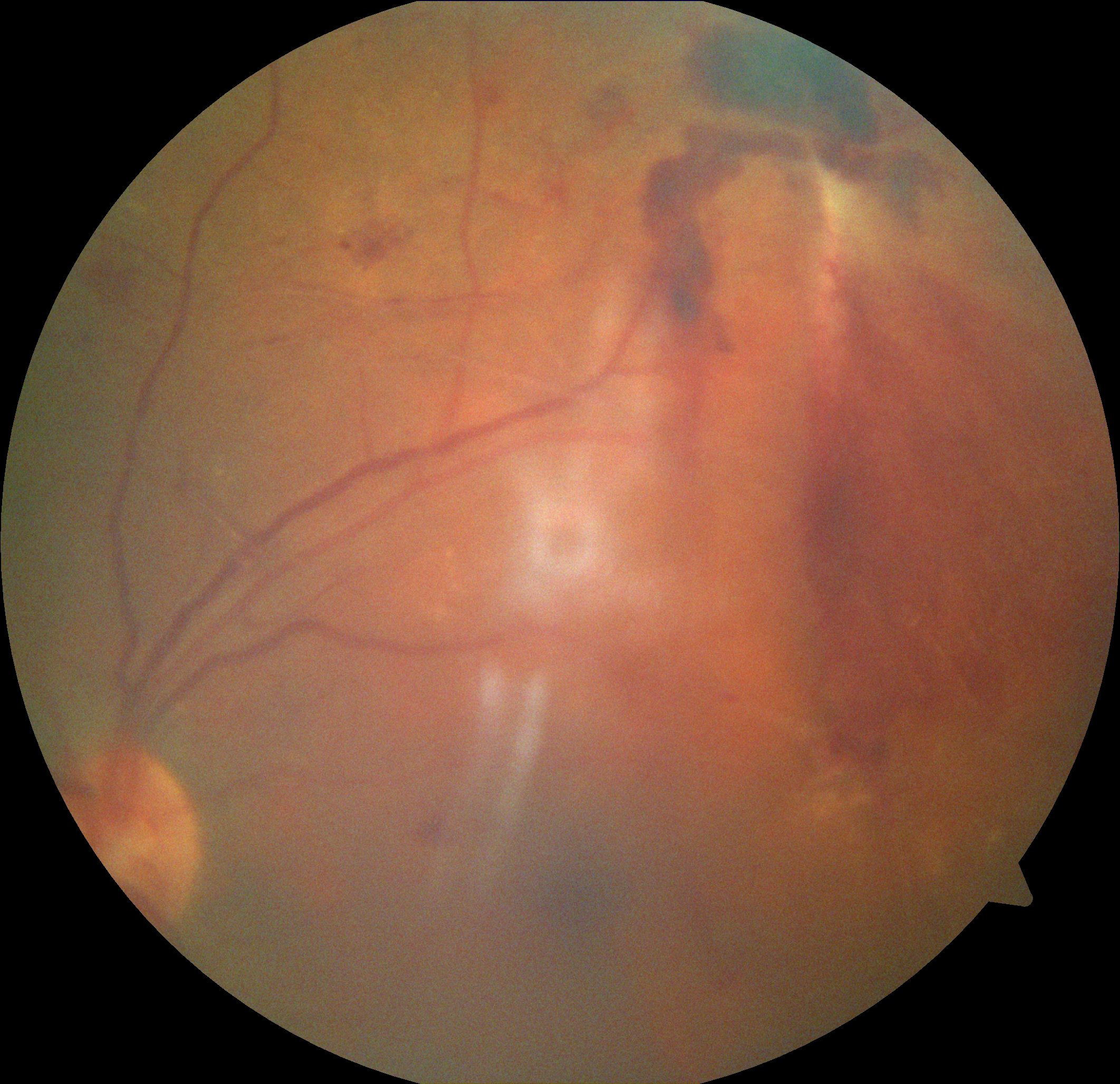DR-Classification Classification Model by first9owing