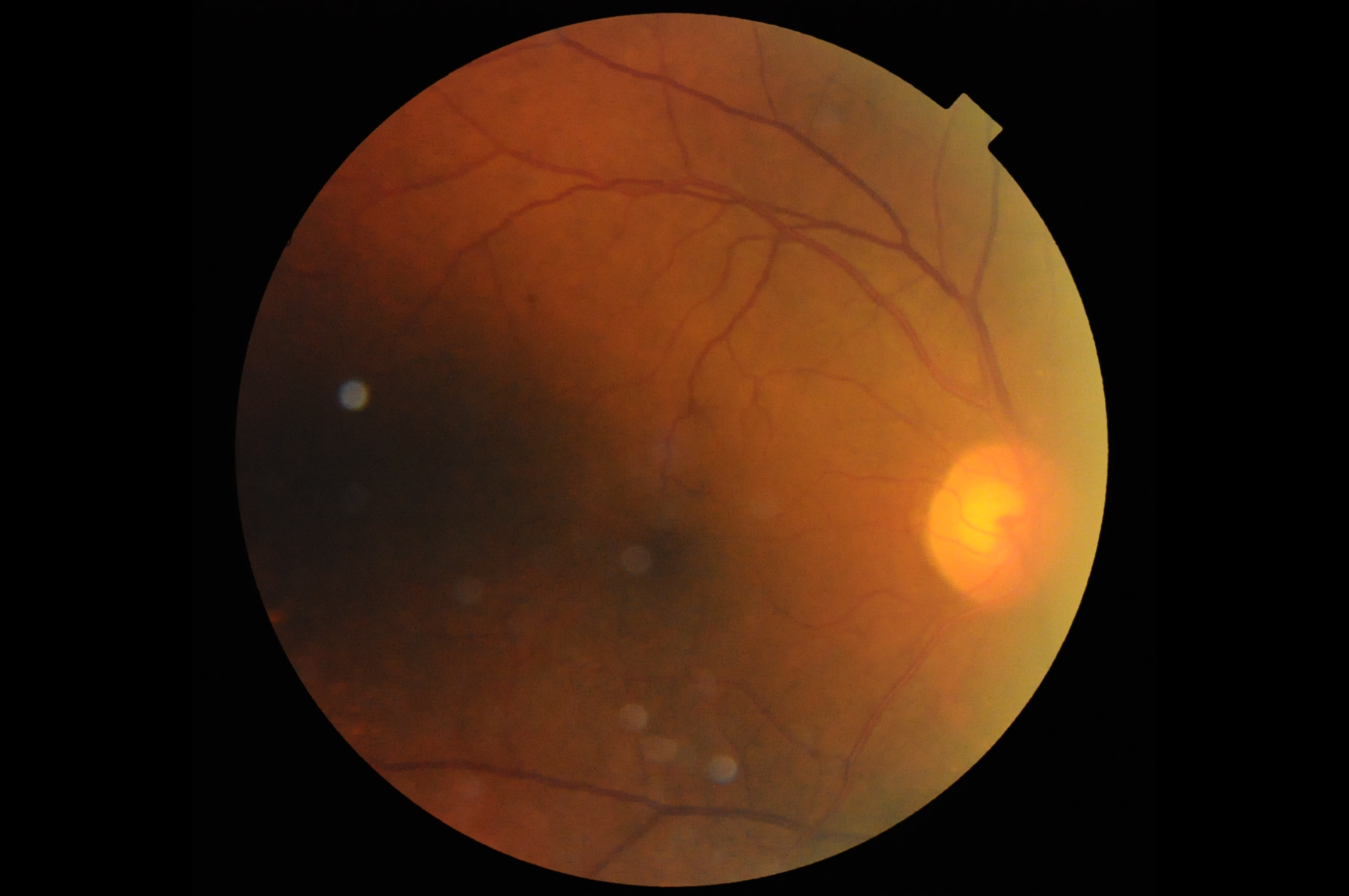 DR-Classification Classification Model by first9owing