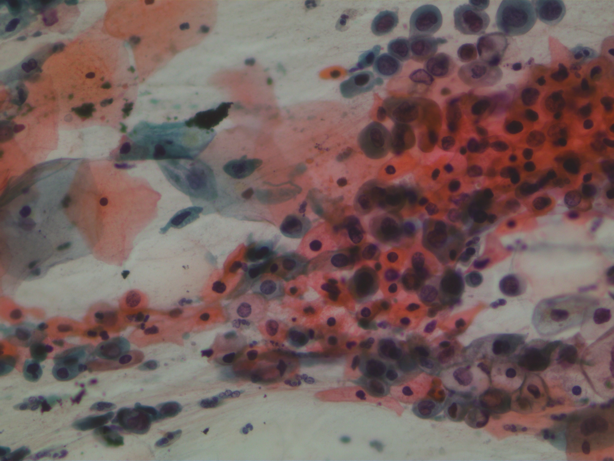 Cervical Cancer Detection Classification Dataset By Projects