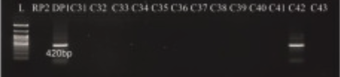 PCR identificator Object Detection Model by PCR Identificador