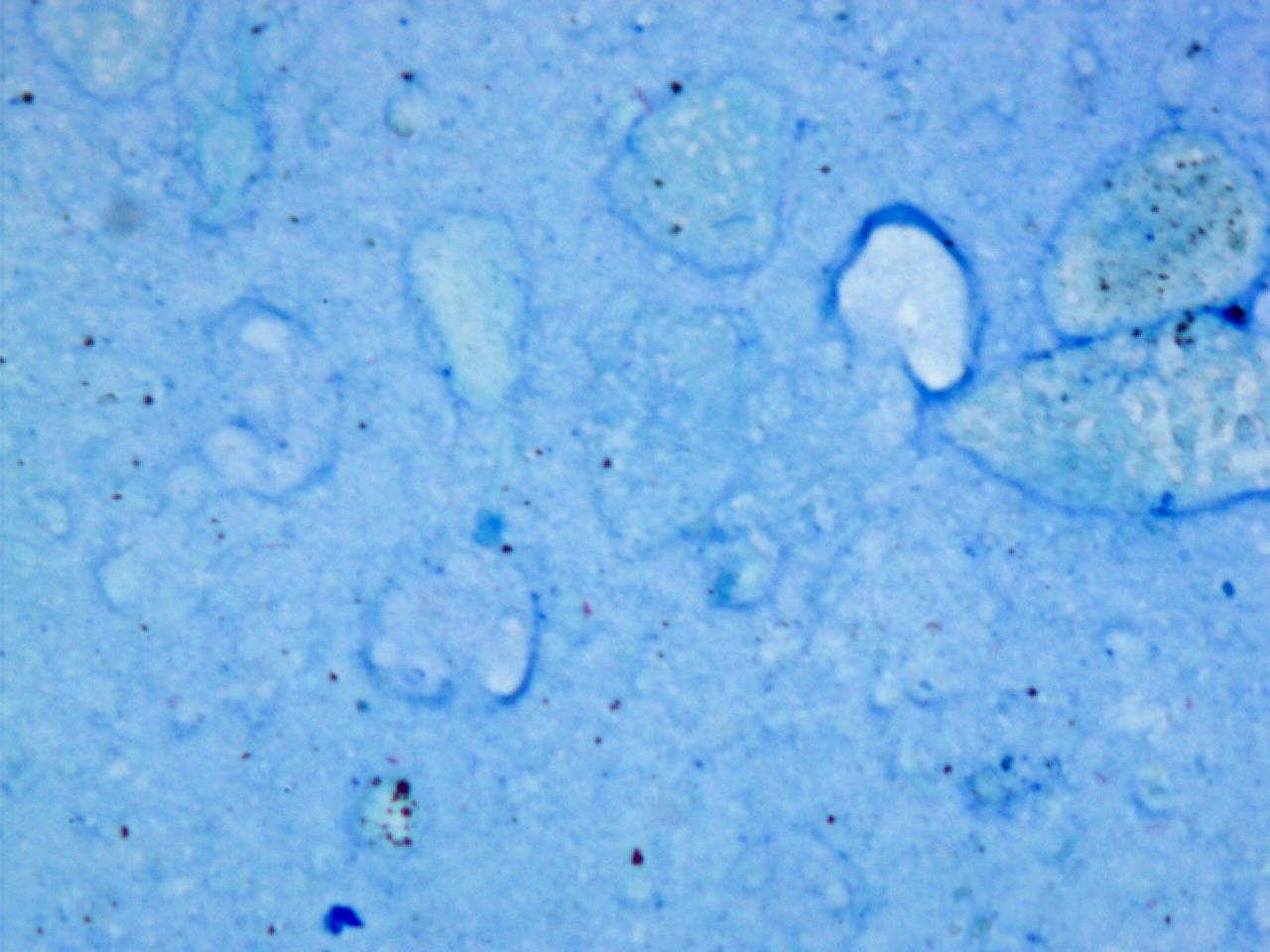 bacteria-600-1100 Object Detection Model by test