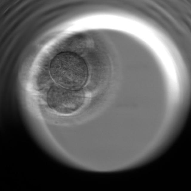 Oocyte Object Detection Dataset and Pre-Trained Model by Oocyte
