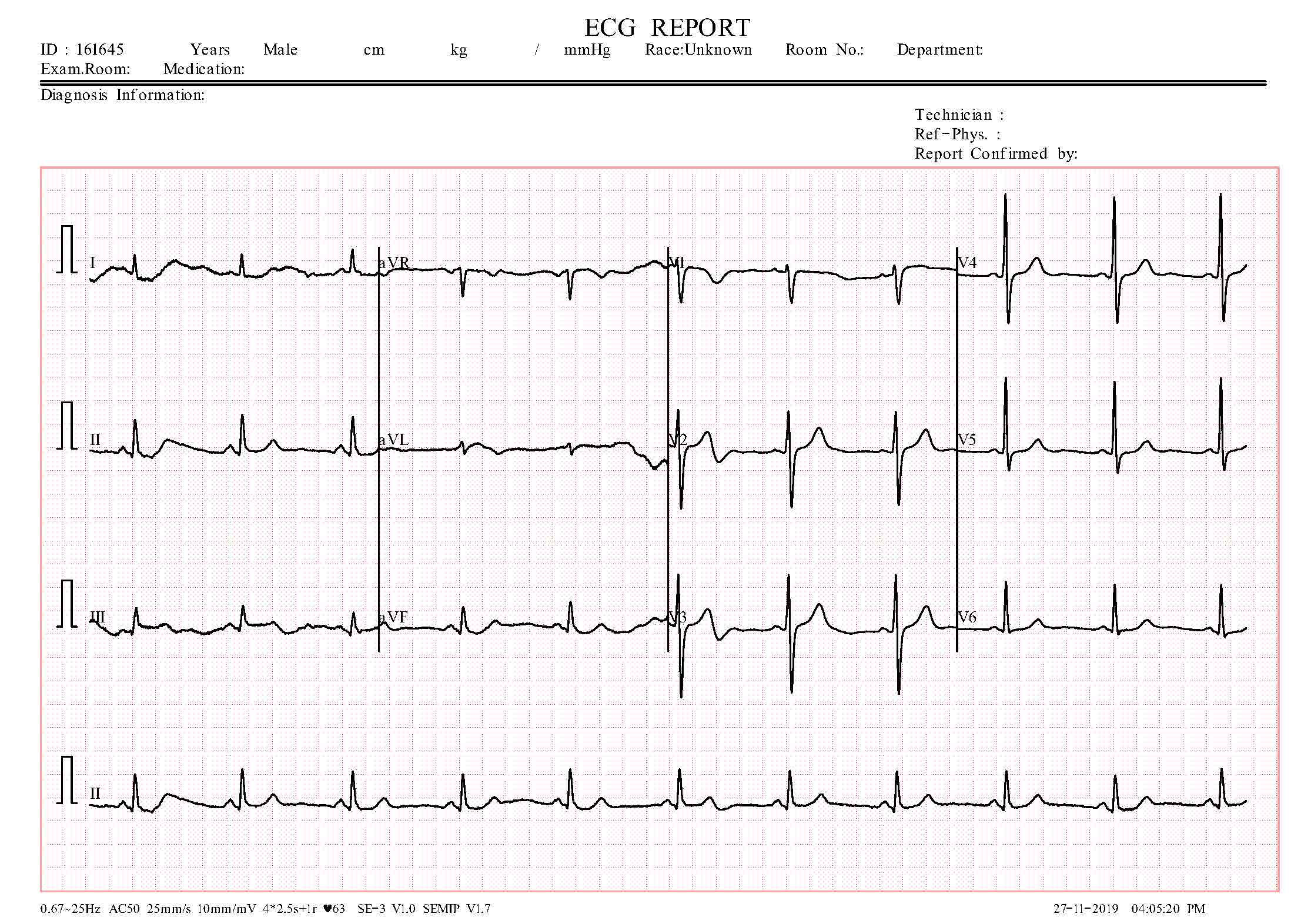 ecg image classification Object Detection Dataset by braddwyer
