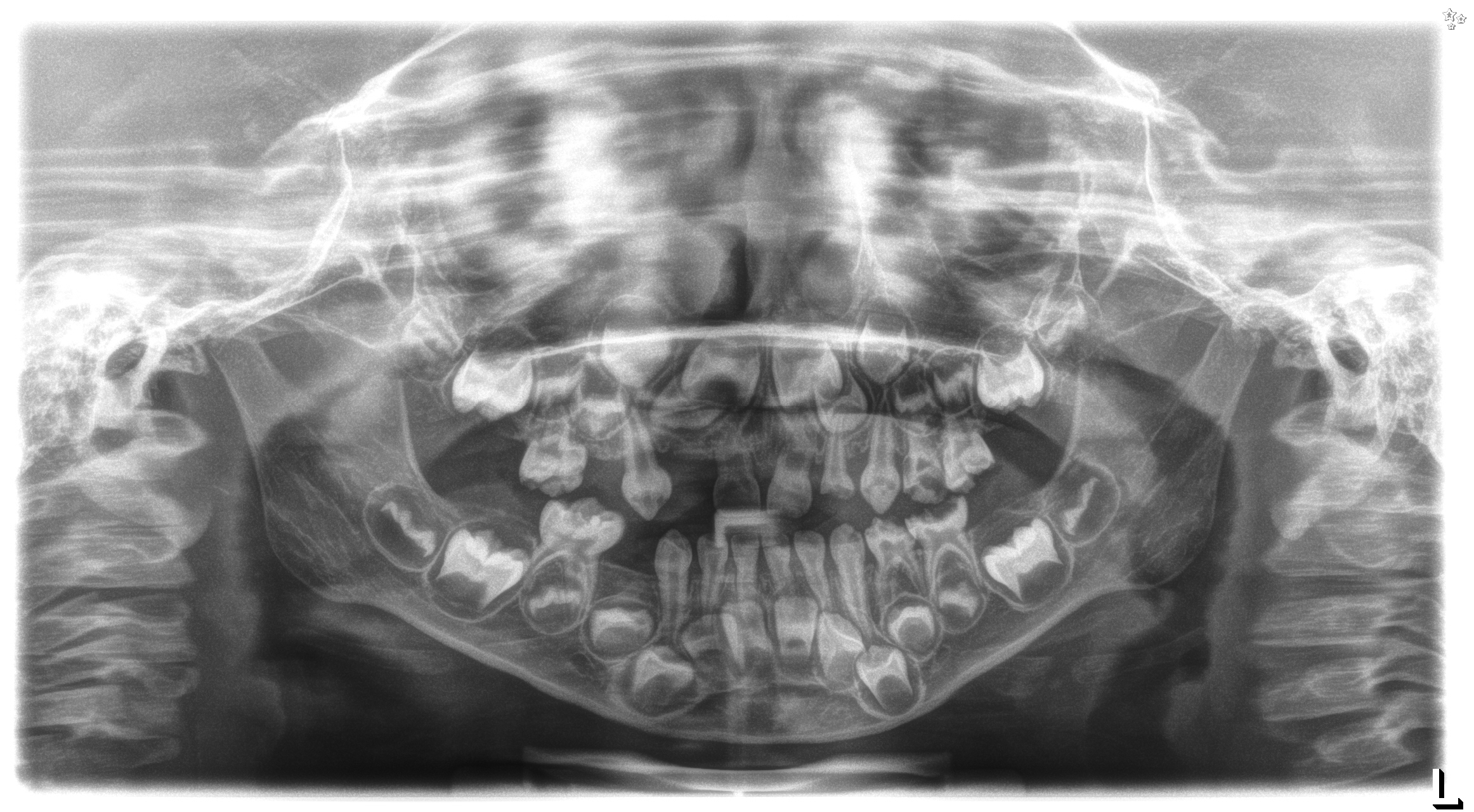 ROI-tooth Object Detection Dataset by University