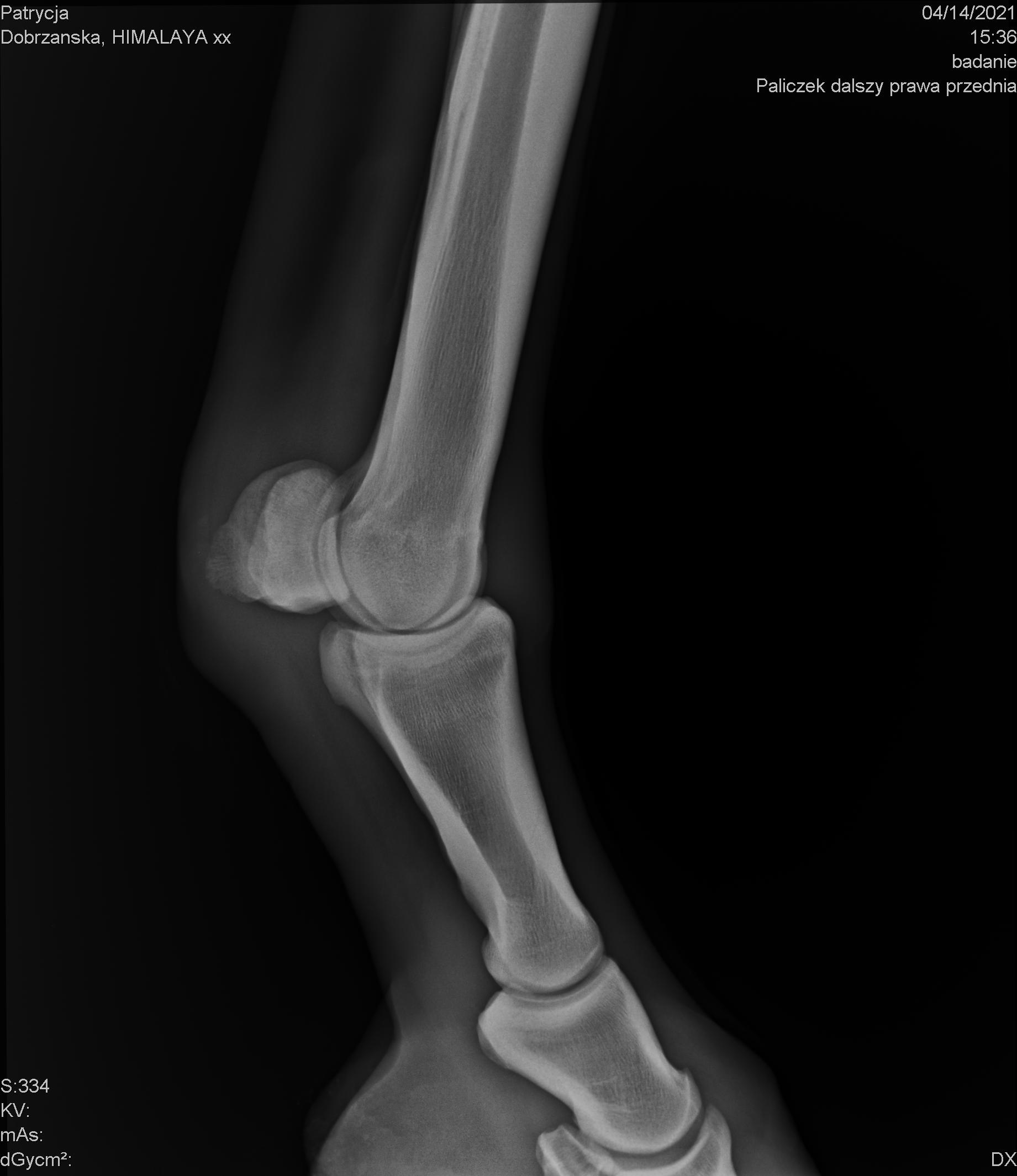 Fetlock Bone Disease Object Detection Dataset and Pre-Trained Model by ...