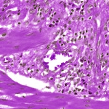 cancer_classify Classification Dataset by DroneDetection