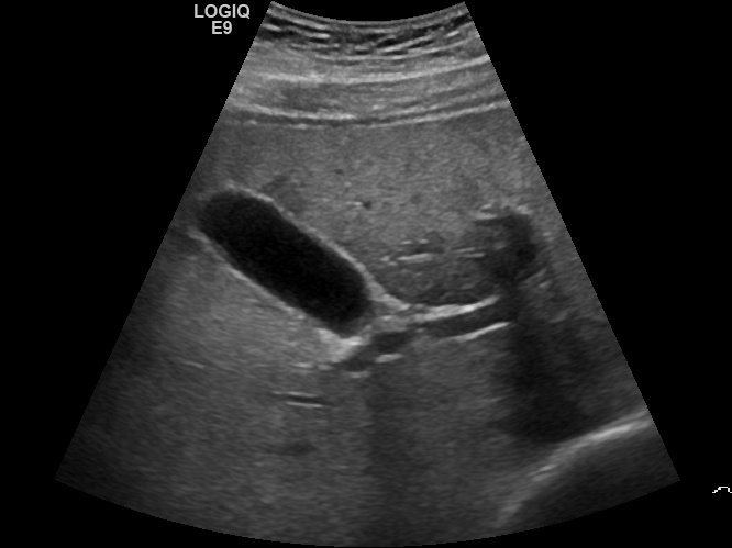 Liver-Detection Object Detection Dataset by Shoshano