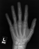 yolodetections - Roboflow Universe